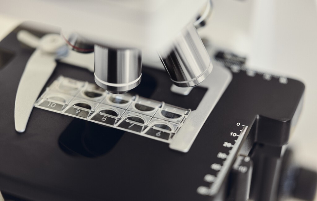 Umfassendes Spermiogramm nach WHO-Standard